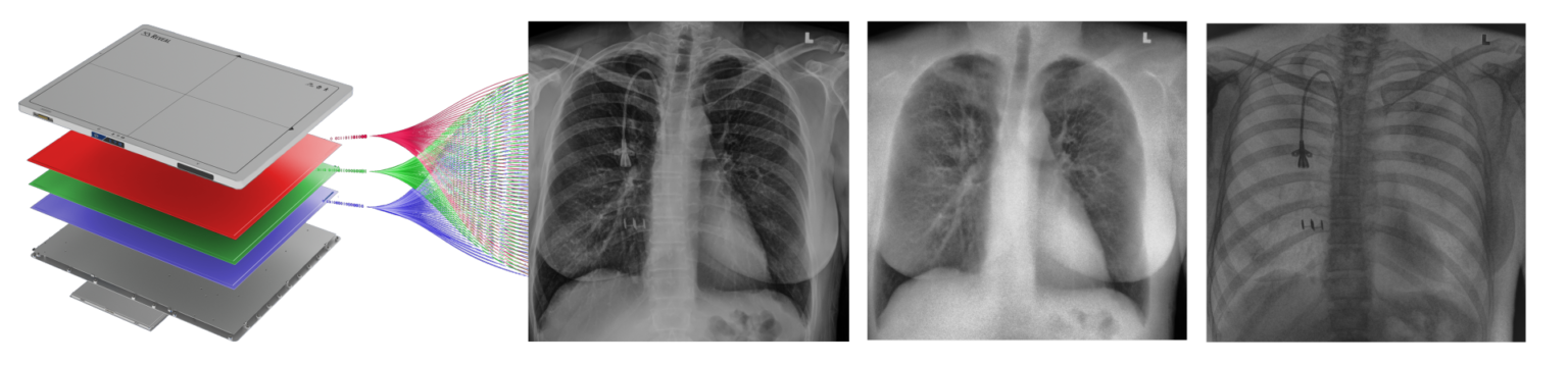 Portable X-ray Package with SpectralDR® | Reveal™ 35C-Dragon