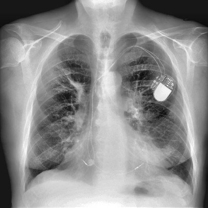Why Quality X-ray Matters for Accurate Diagnosis | KA Imaging