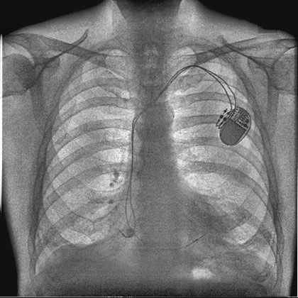 Why Quality X-ray Matters for Accurate Diagnosis | KA Imaging