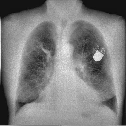 Why Quality X-ray Matters for Accurate Diagnosis | KA Imaging