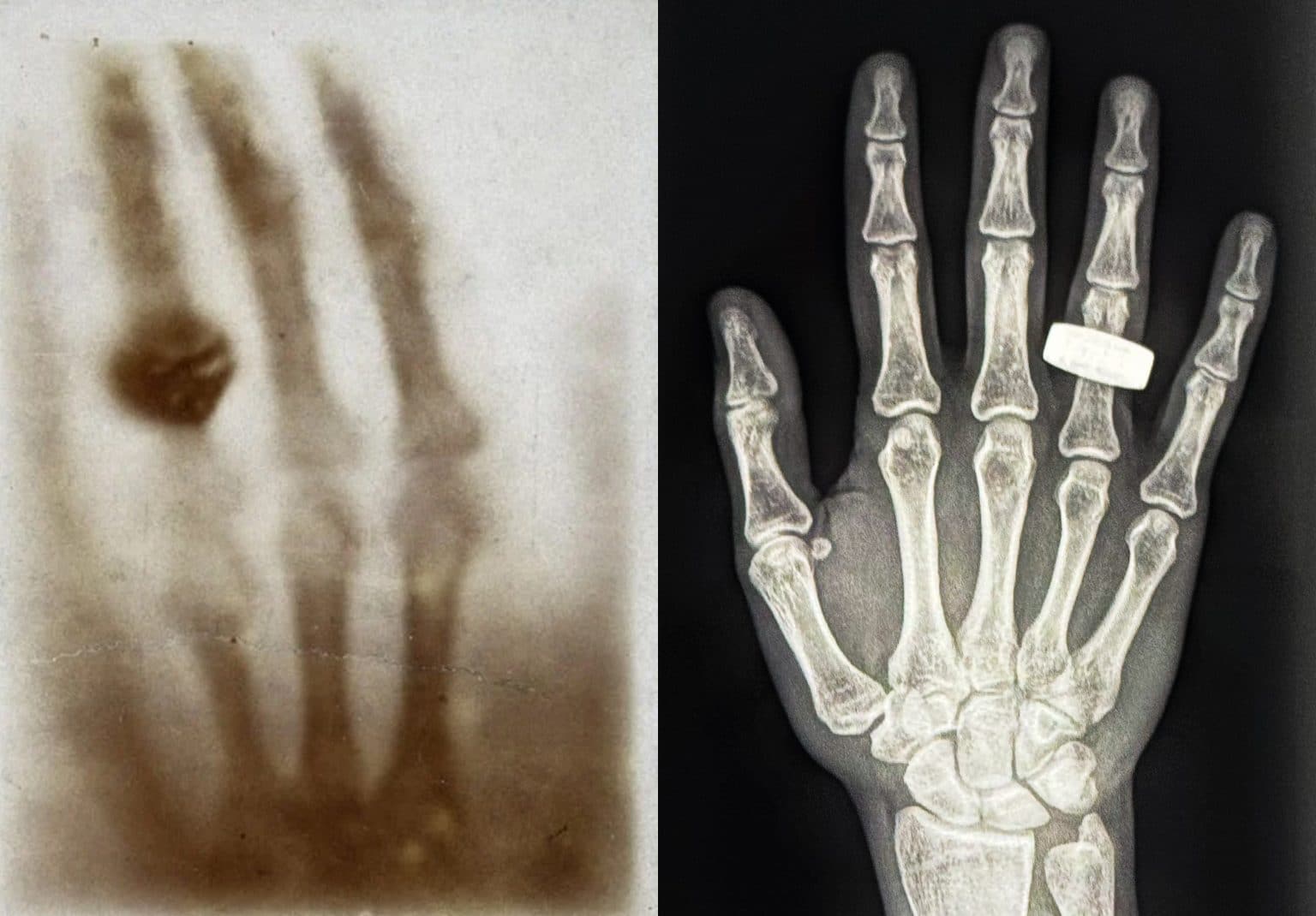 Why the First X-ray in Space is a Hand with a Ring—and Why It Matters